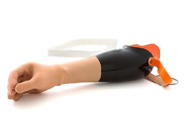 Mechanische of lichaamsbekrachtigde armprothese | OIM Orthopedie