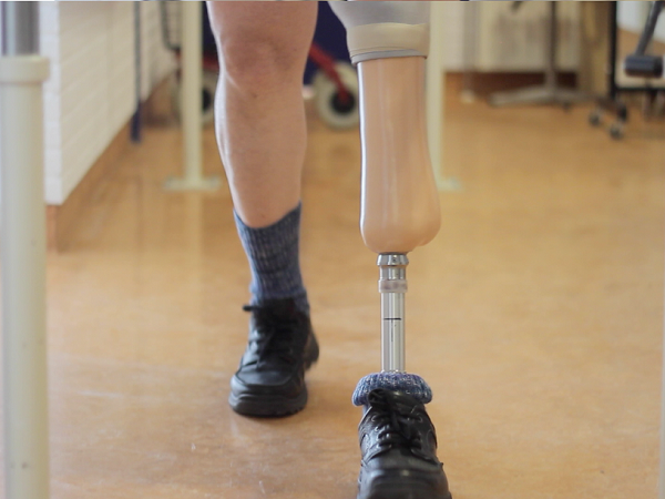 Oefenen met je beenprothese | OIM Orthopedie