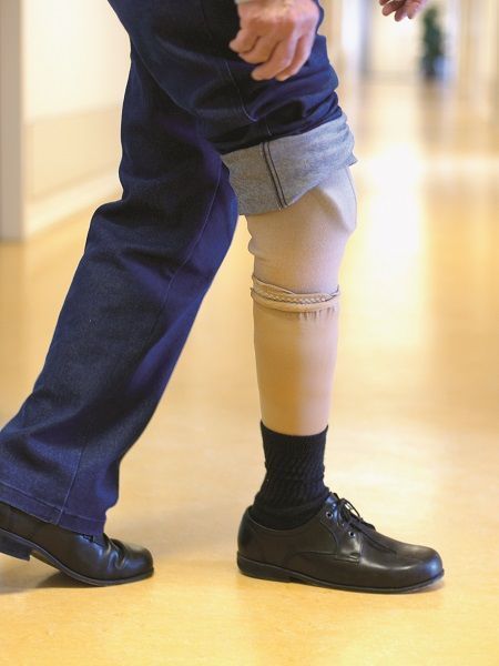 Je beenprothese is klaar | OIM Orthopedie